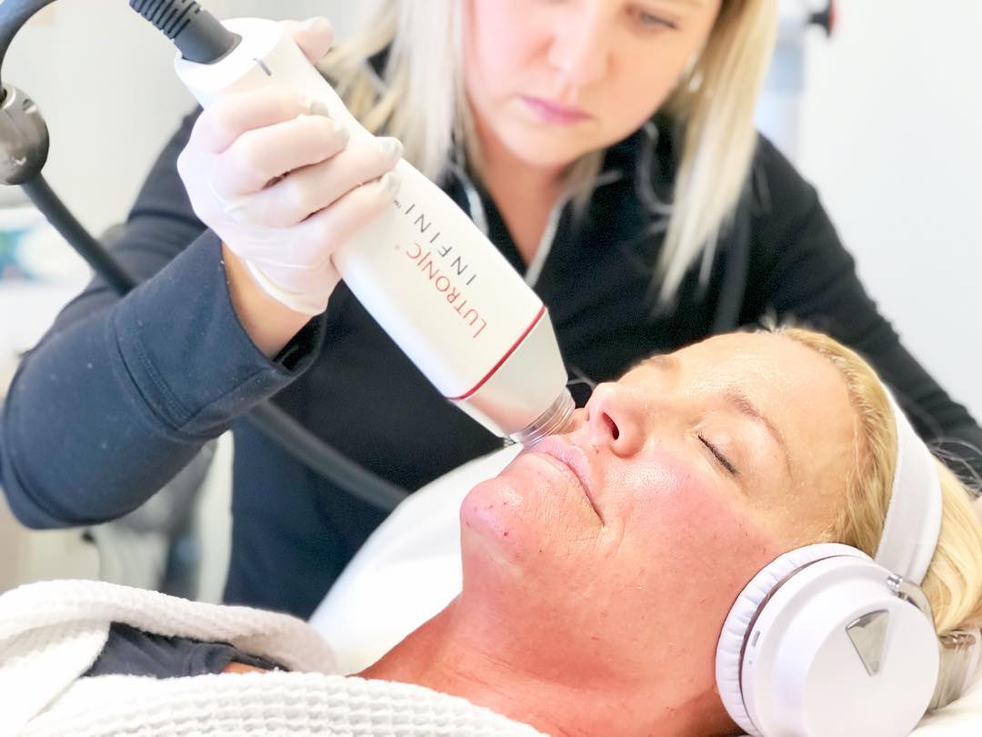 Infini Treatment in Birmingham | Dermatology & Laser of Alabama